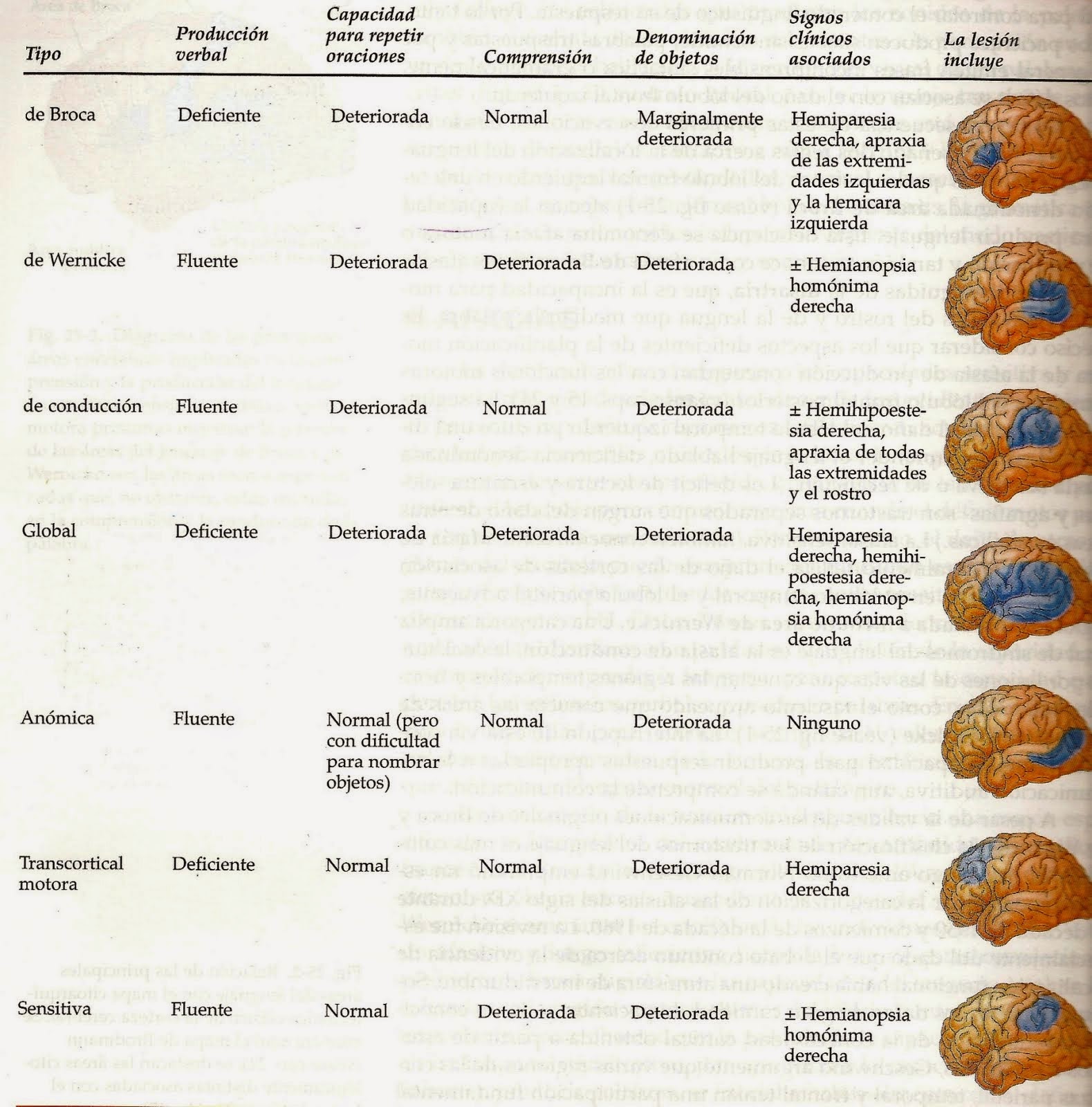 Afasia global. No todo está perdido.: TIPOS DE AFASIA Y DEFINICIÓN DE ...